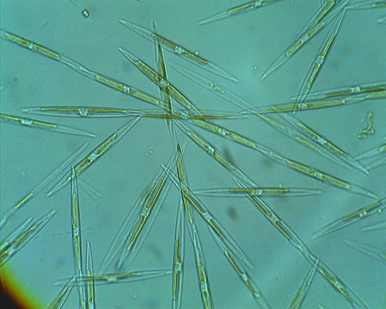 Scientists Discover Genetic Basis for Toxic Algal Blooms | J. Craig ...