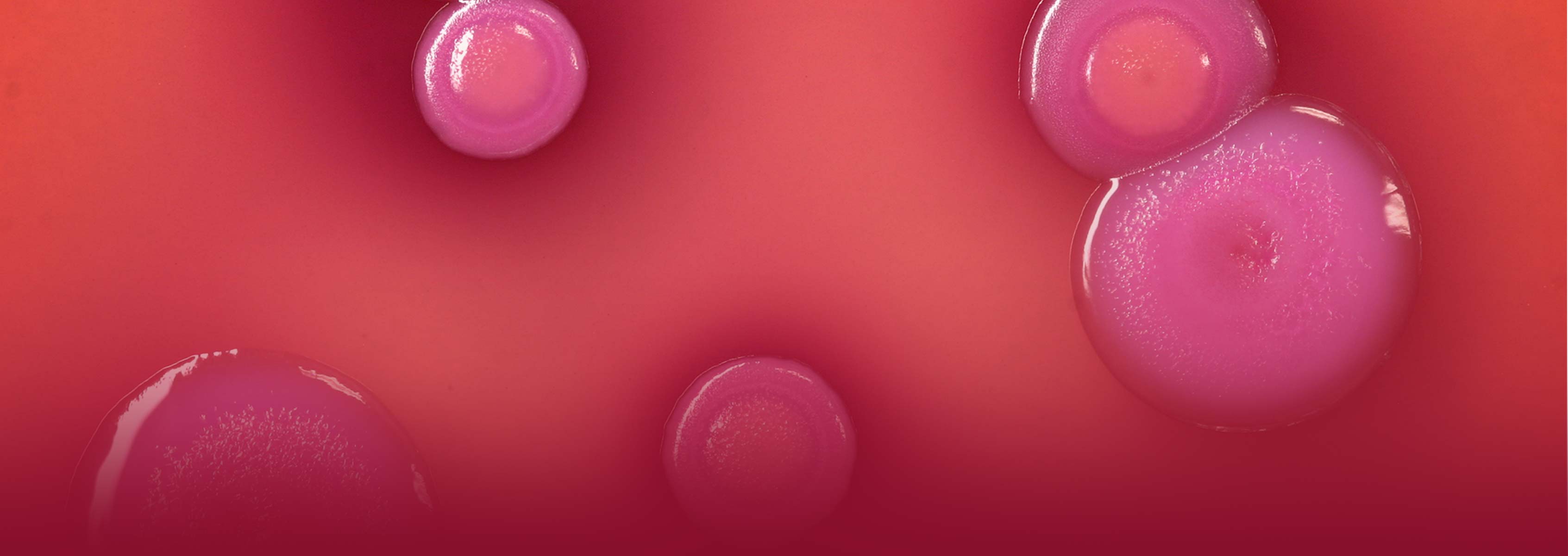 Genomic Center for Infectious Diseases (GCID) | J. Craig Venter Institute