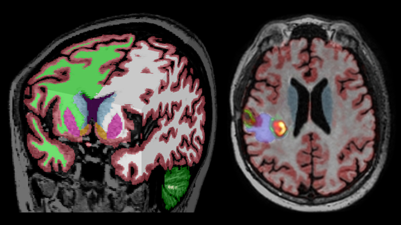 Leading neuroscientist and AI geneticist Anders Dale, Ph.D. named ...